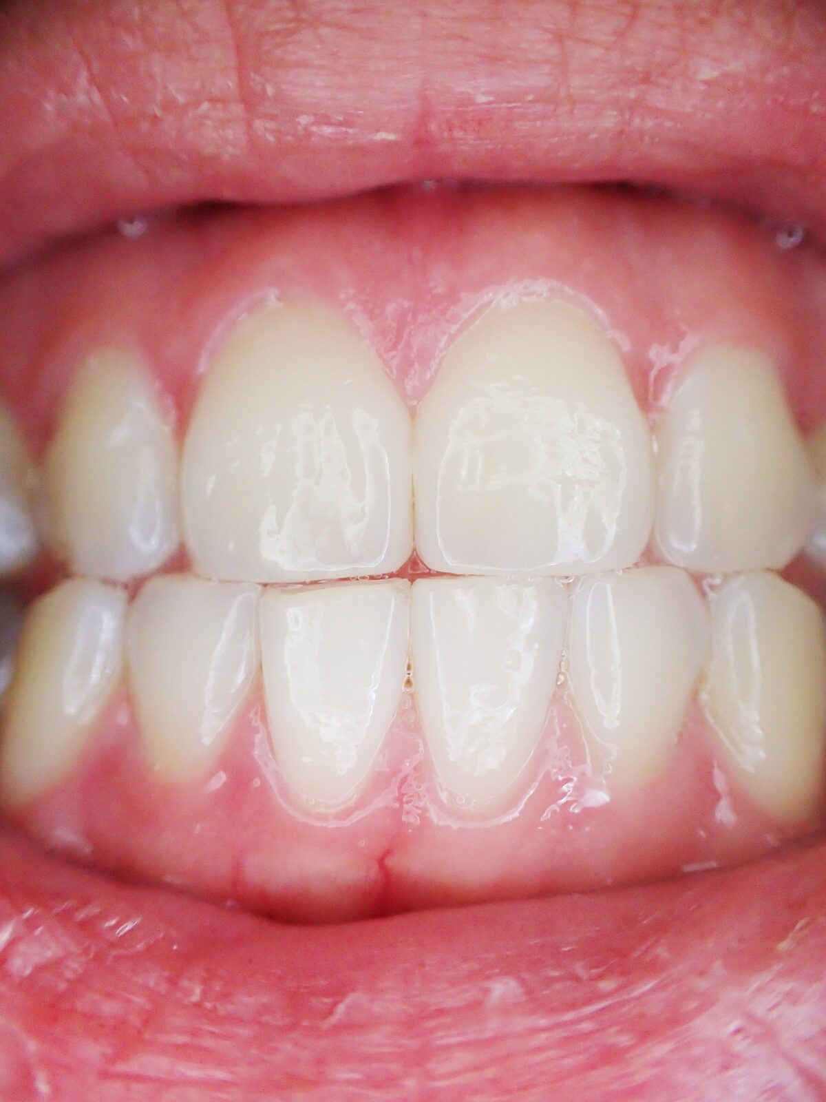 The Benefits of Eating Apples for Your Teeth and Gums. – My Dentist Hub
